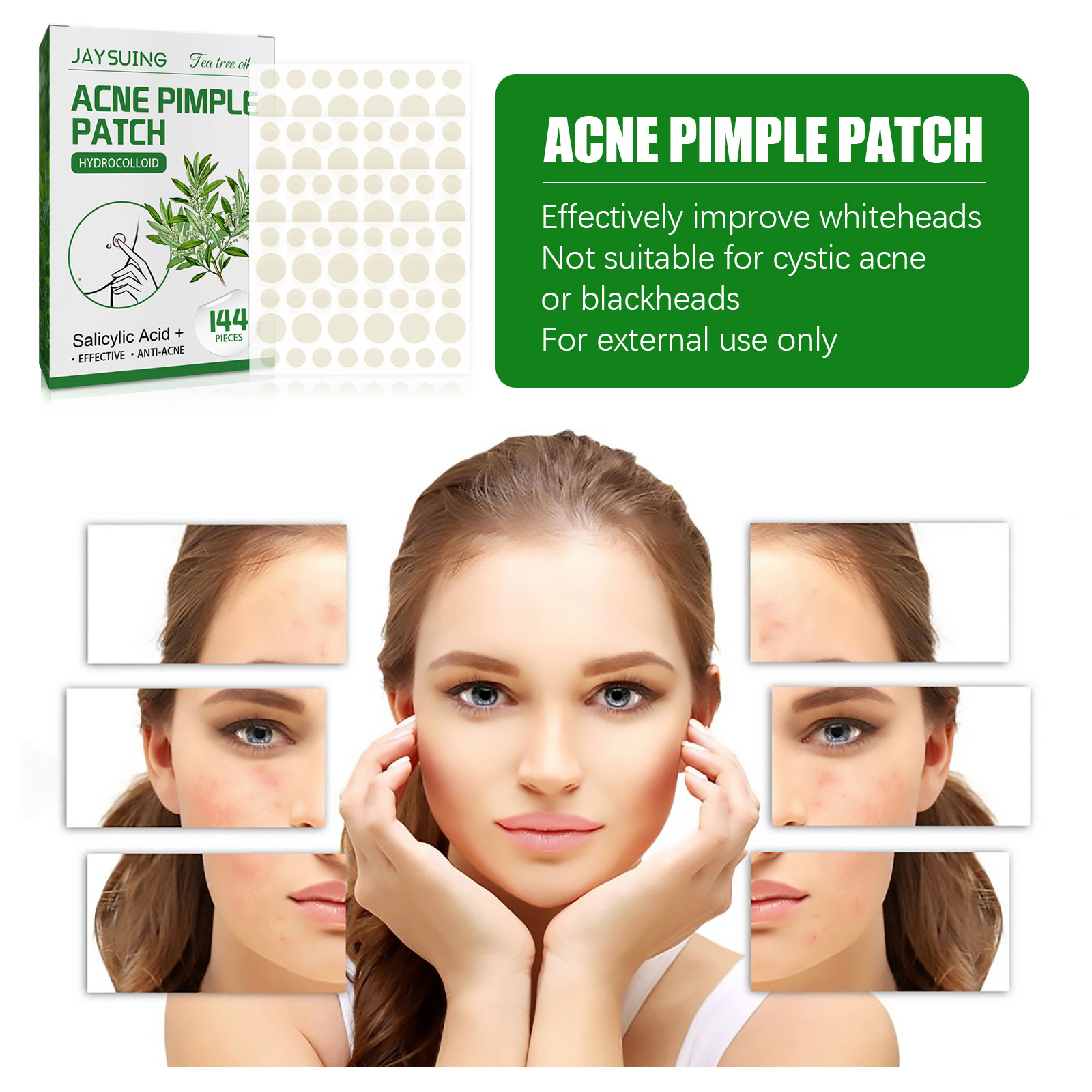 Zorbes Acne Pimple Patch for Skin Clear Face Acne Cleansing Patches ...