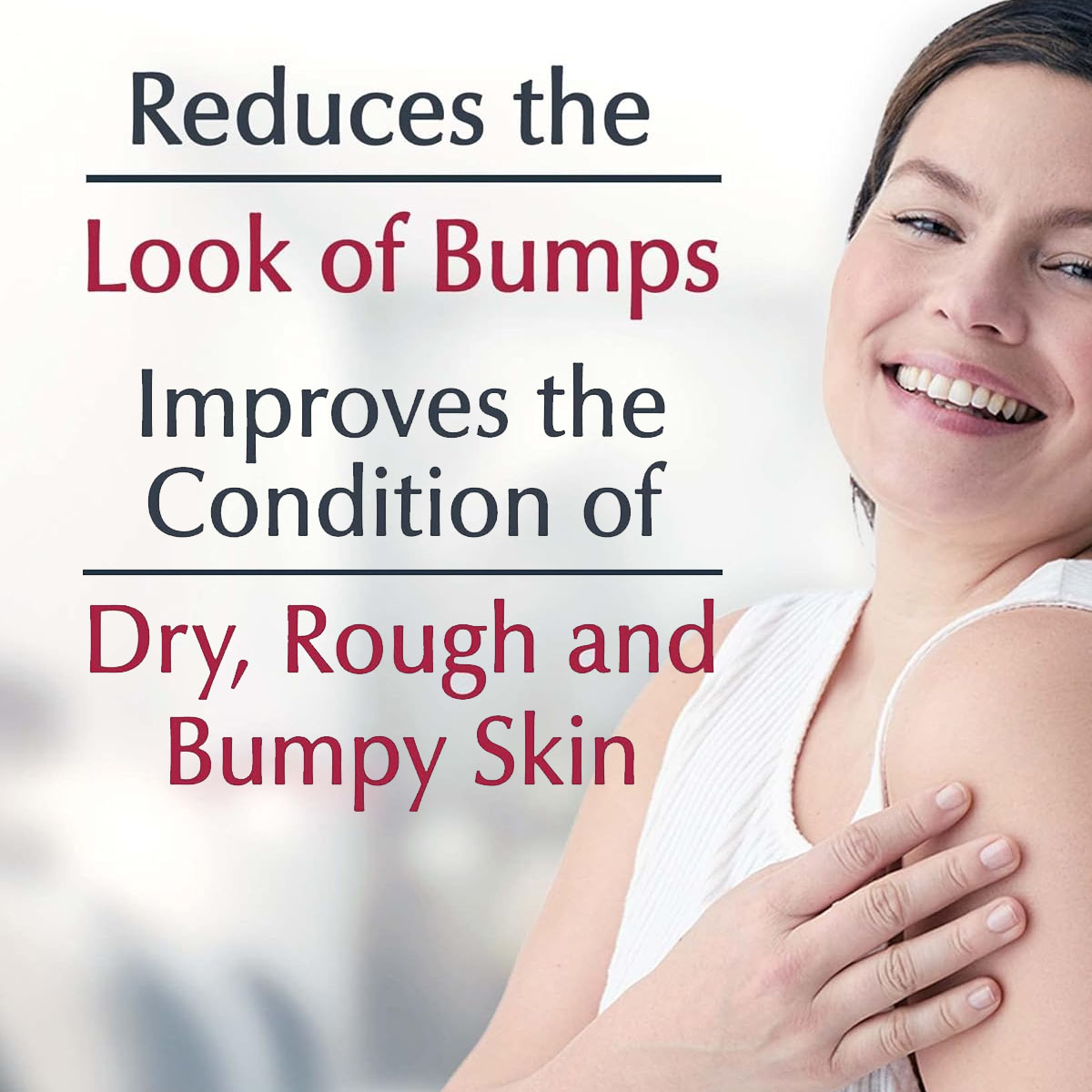 Roughness Relief Cream Body Lotion for Extremely Dry Skin Rough Skin w ...