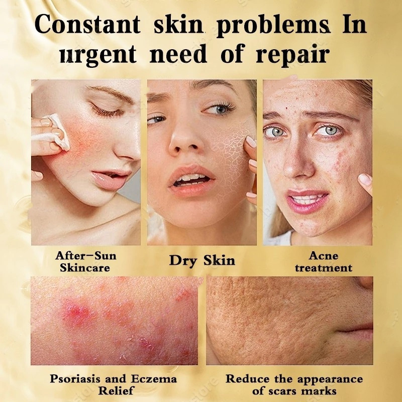 【BUY 1 TAKE 2】Vitamin C Toner Set Essence Whitening Face and Body ...