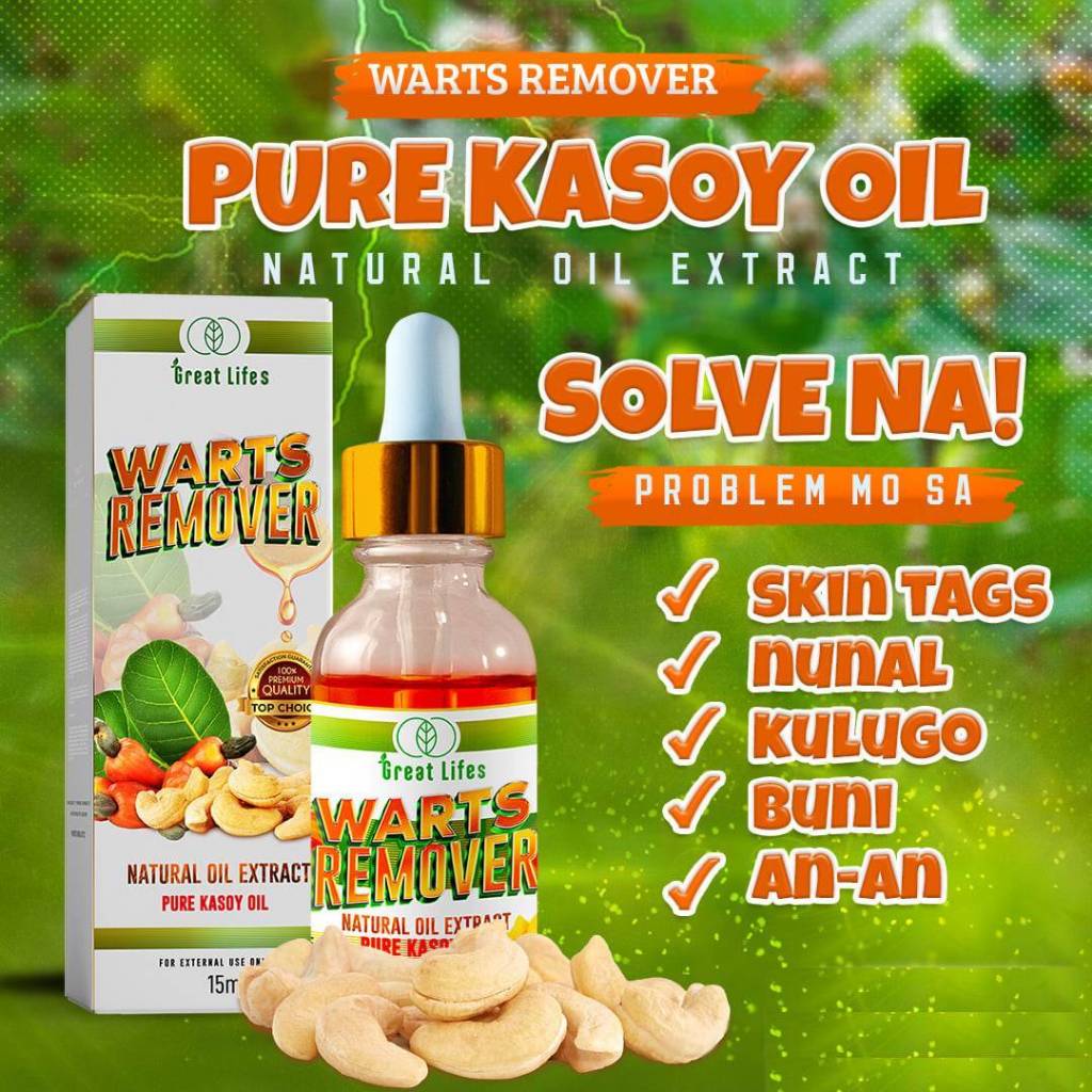 Kasoy Oil Warts Remover Mole Remover Effective Skin Tags And Warts ...