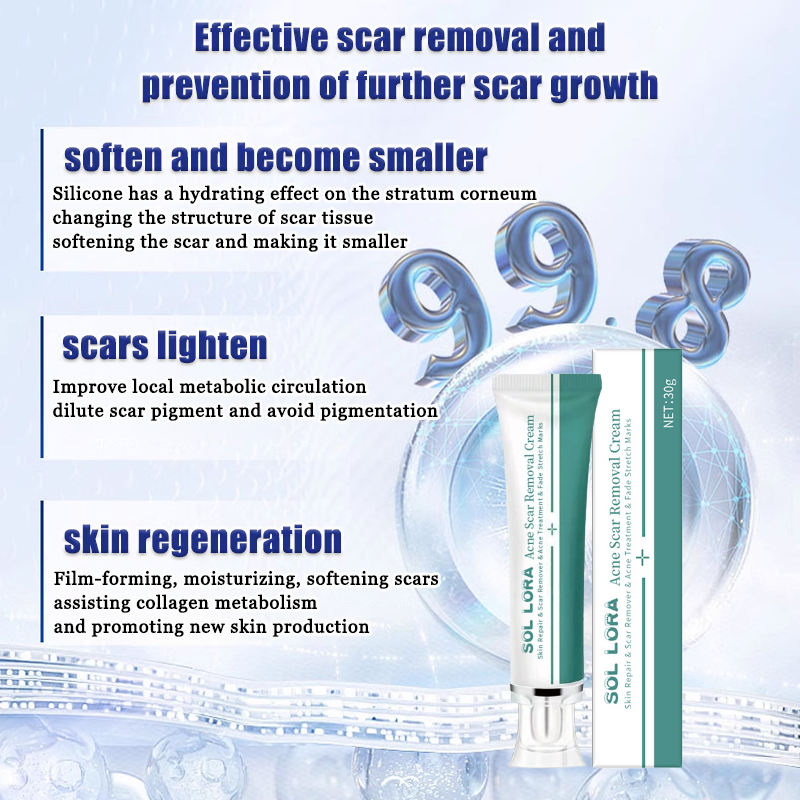 SOL LORA 30g pimple remover cream acne scars removal for face ...