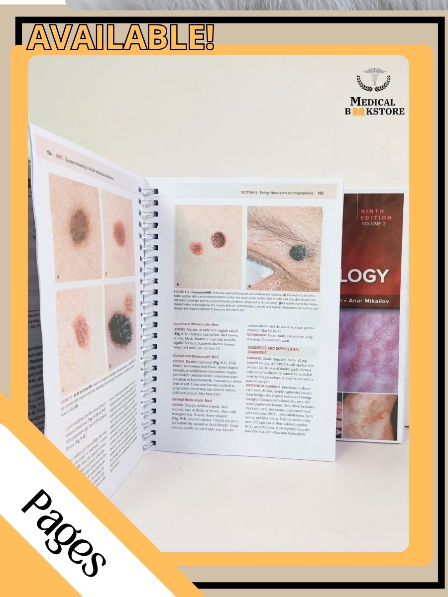 Fitzpatrick's Color Atlas and Synopsis of Clinical Dermatology 9th ...