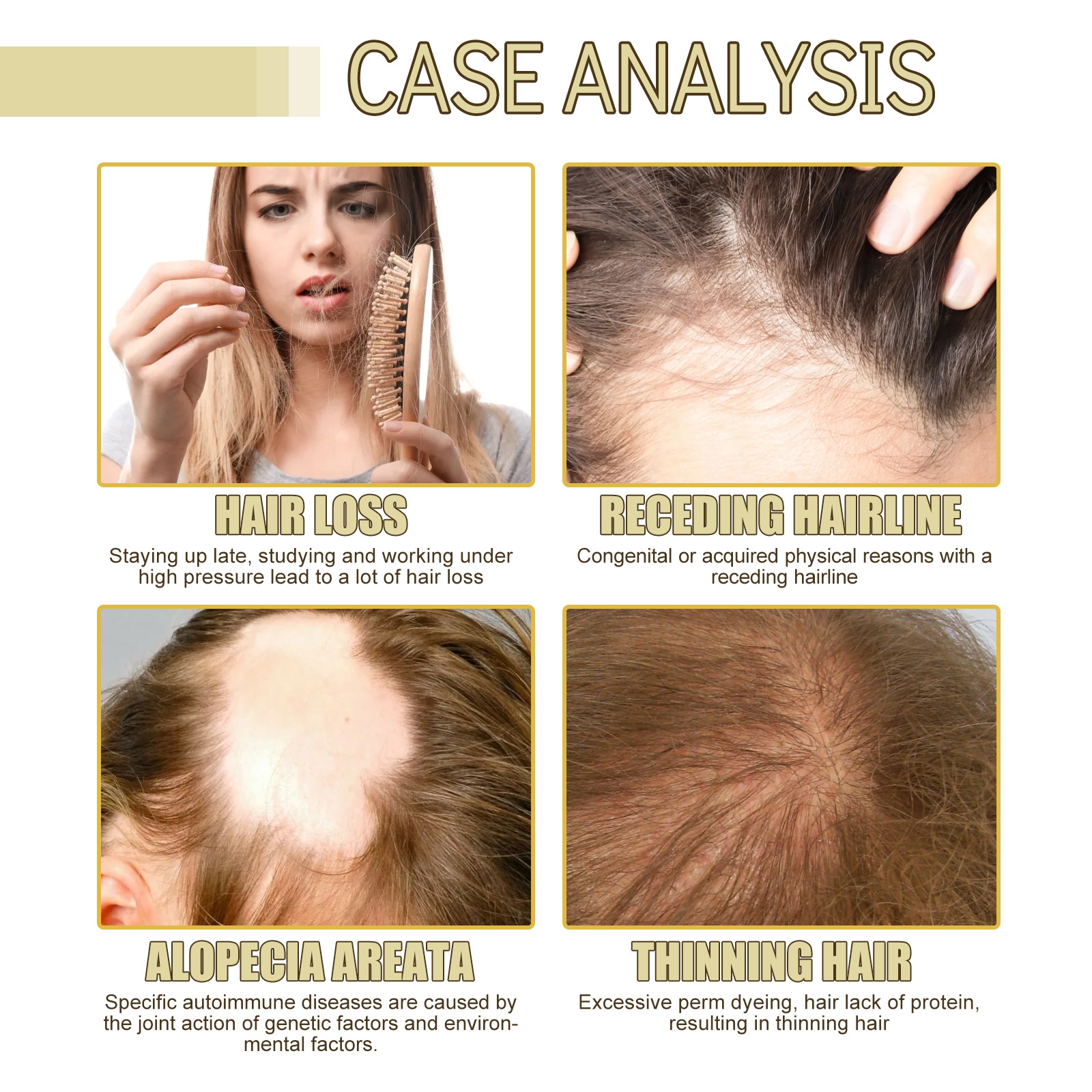 Rosemary Hair Growth Serum Fast Hair Growth Spray Hair & Scalp ...