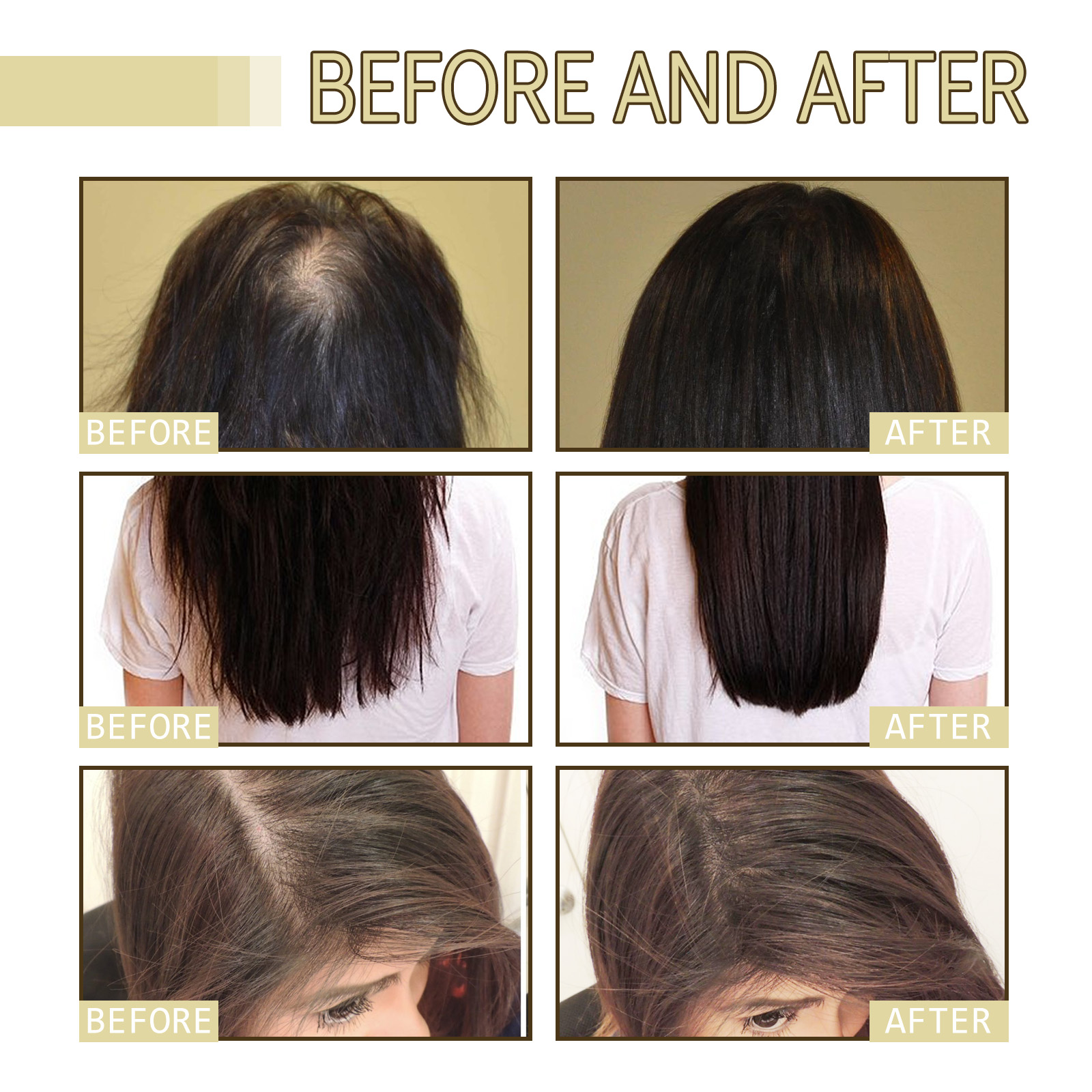 Rosemary Hair Growth Serum Fast Hair Growth Spray Hair & Scalp ...