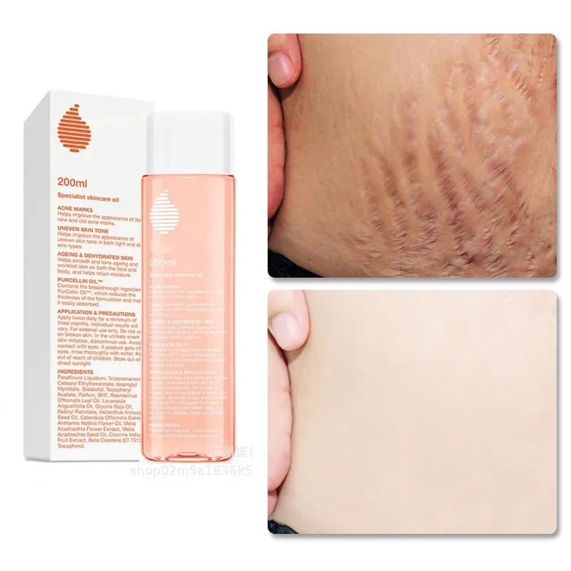 Bio-oil Facial Repair Oil, used for removing scars, eliminating stretch ...