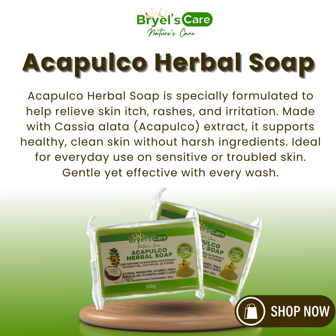 Acapulco Herbal Soap 100g Anti Fungal Body Soap(Itchiness,Eczema,Tinea ...