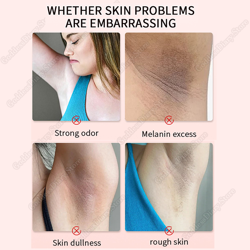 (BUY 1 TAKE 1) Japan Intensive Whitening Underarm Powder Dry Deodorant ...
