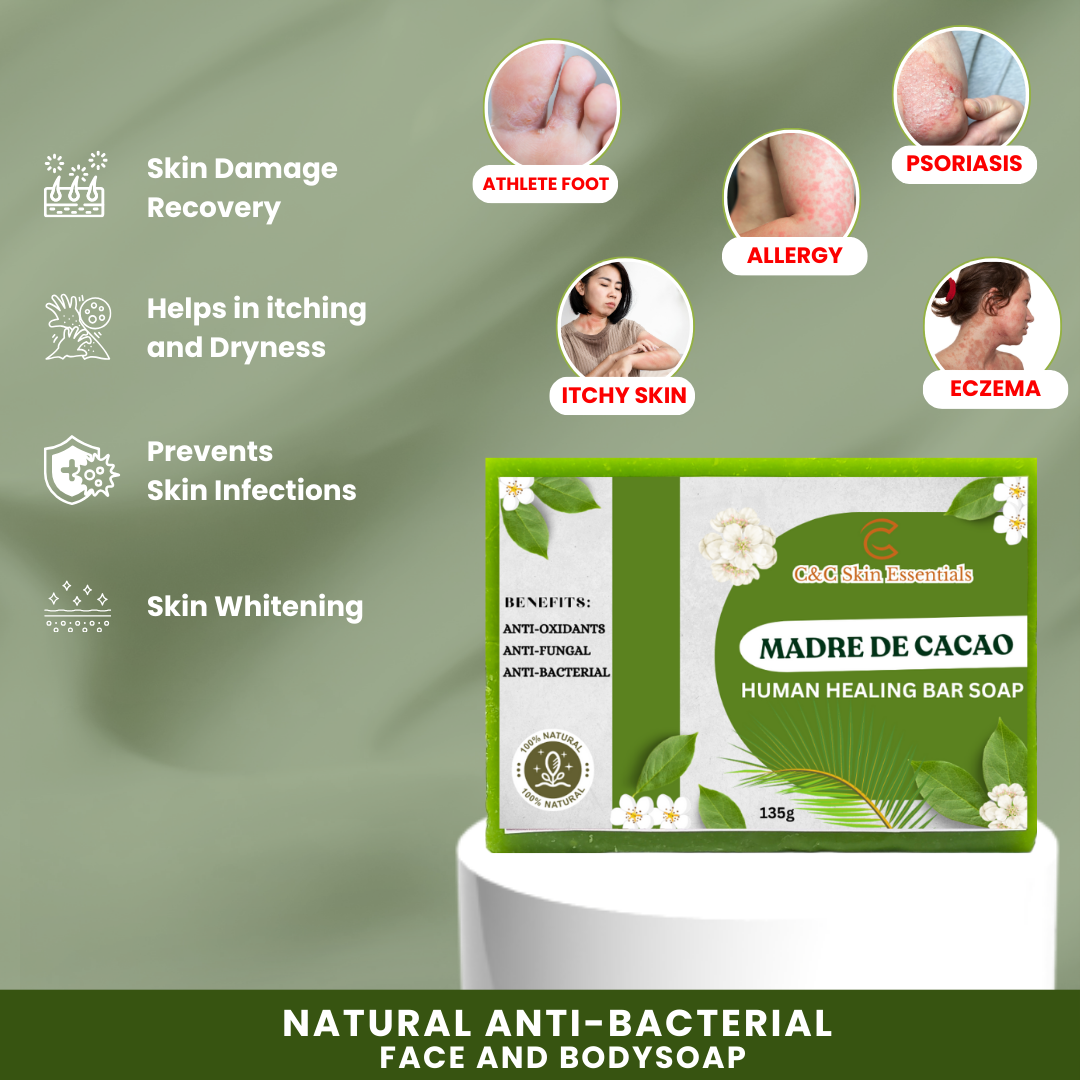 Madre De Cacao Soap for Human Skin Problems: Anti bacterial Soap, Anti ...