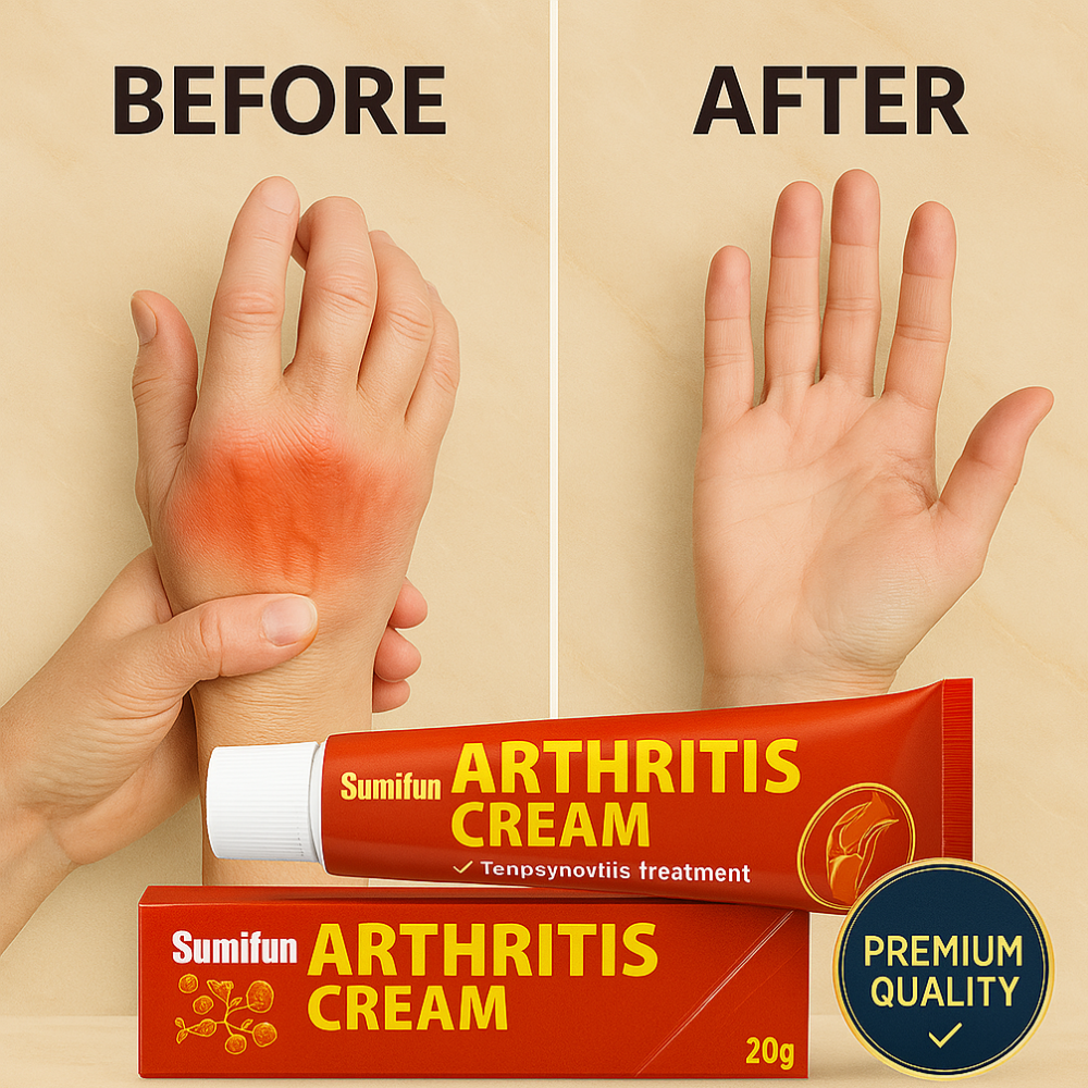 Herbal Arthritis Cream for Joint Pain, Rheumatism, Swelling, Muscle ...