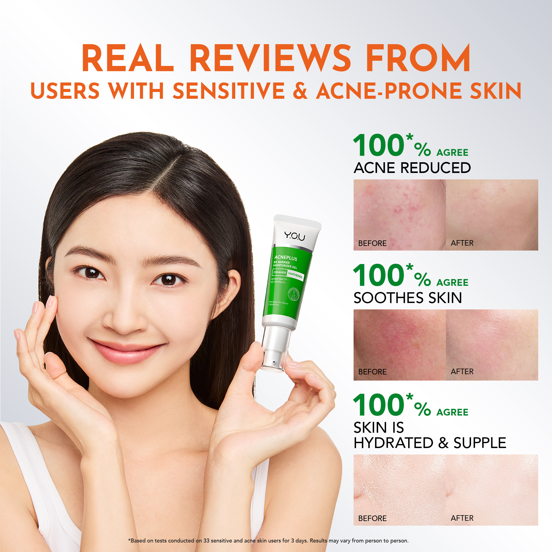 Y.O.U Complete Acne Solution | Acneplus New Series | Reduce Acne | Anti ...