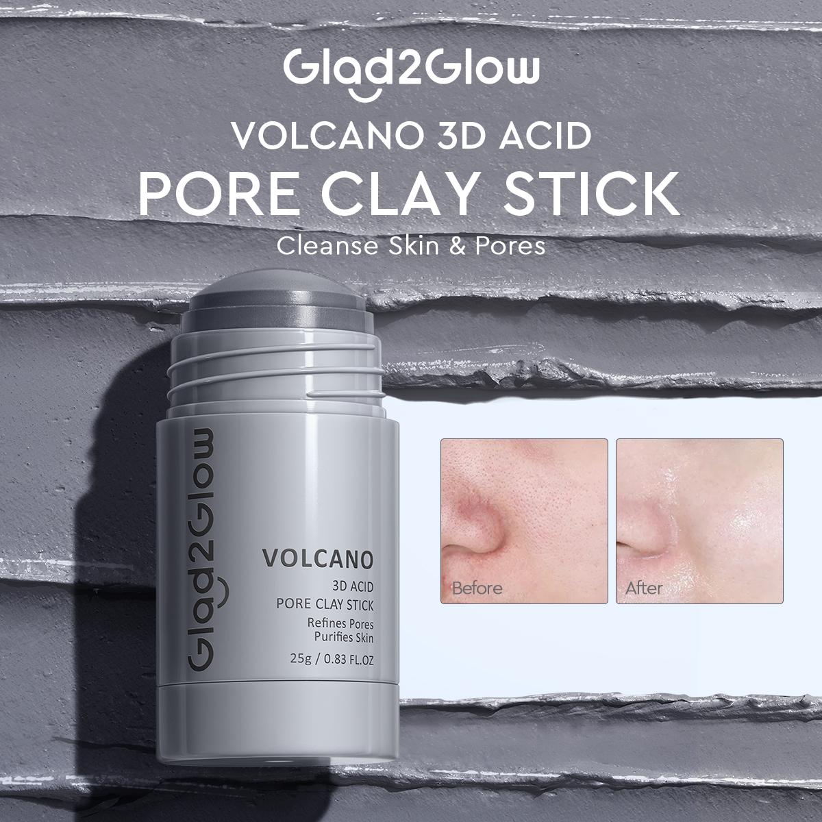 [HOT]Glad2Glow Volcano 3D Acid Pore Clay Stick Mask Blackhead Oily Acne ...