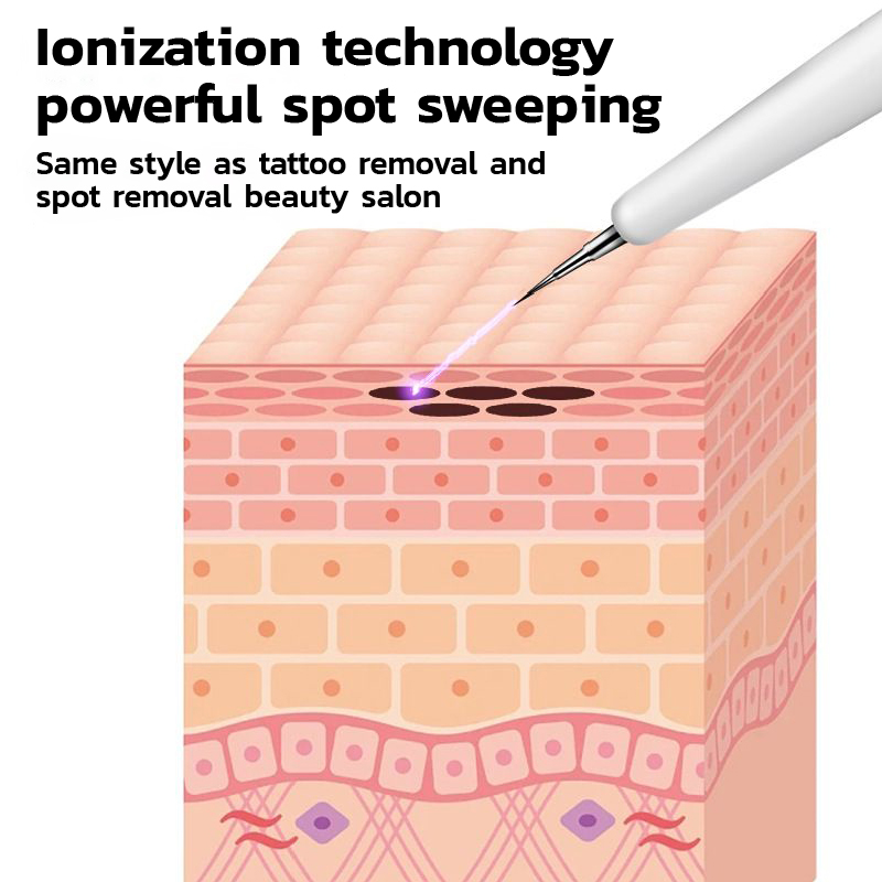 Mole Removal Machine Facial Laser Freckle Electronic Device Skin Care ...