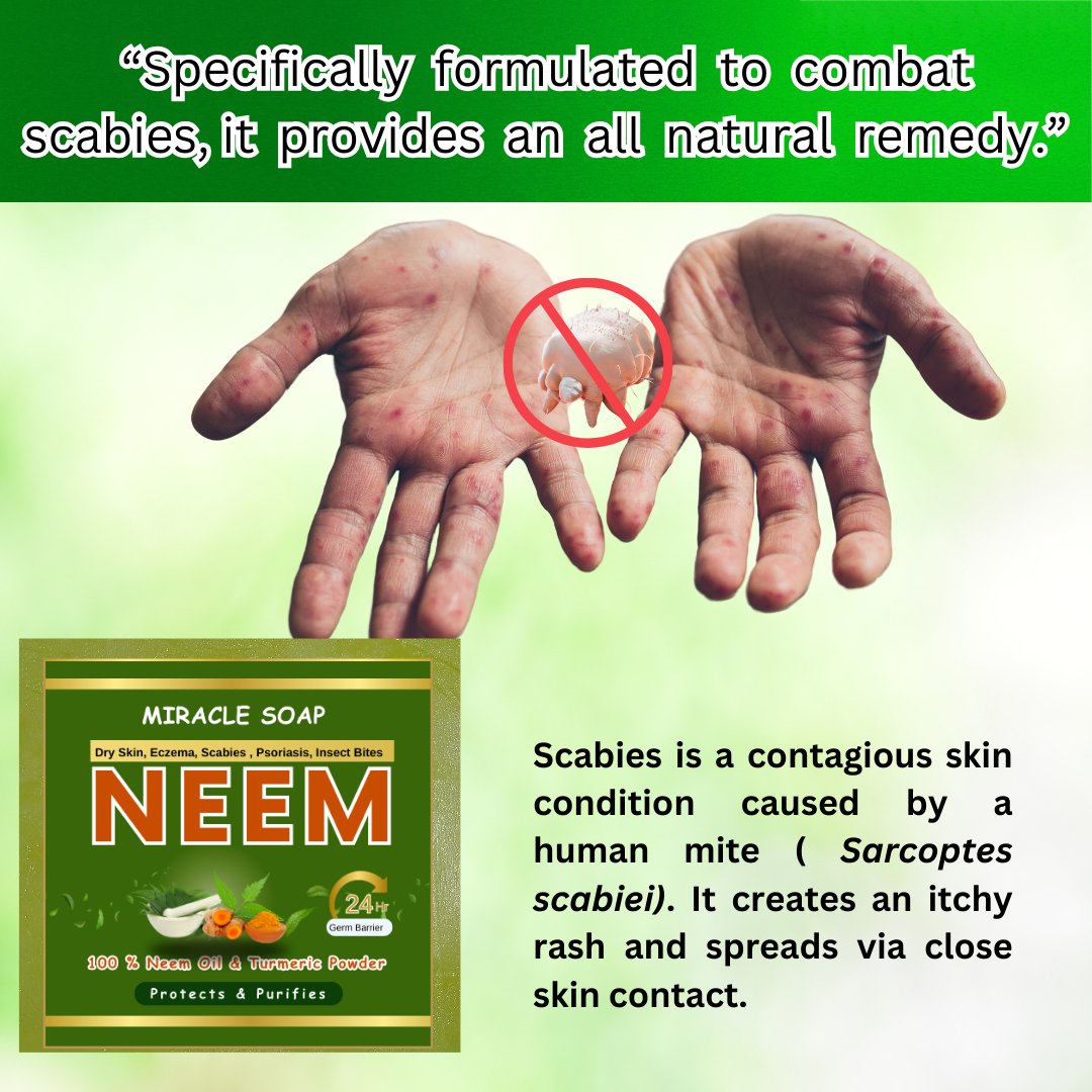 70 g NEEM SOAP Relieves itchiness , treats eczema, and other skin ...