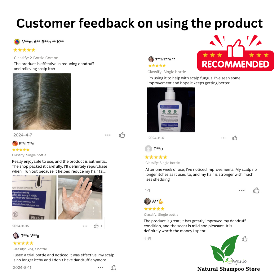 Biocare Santal 300 Shampoo–Herbal anti-dandruff shampoo that fights ...