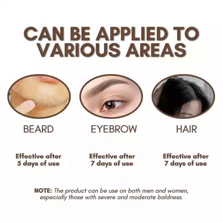 HOSOKU MINOXIDIL 15% ORIGINAL Hair Growth With Collagen And Castor Oil ...