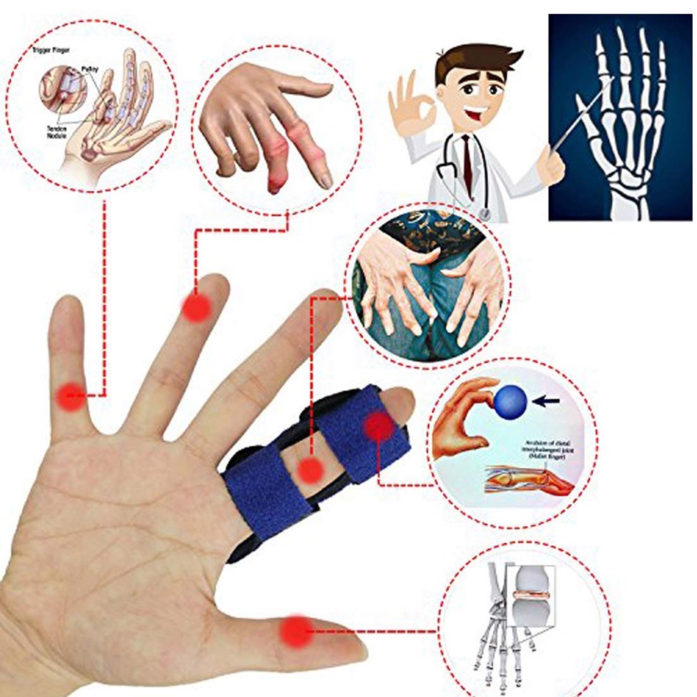 Adjustable Finger Splint Brace Built-in Aluminum Alloy Mallet Finger ...
