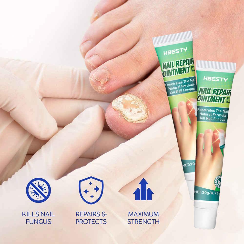 Nail Treatment Paronychia Remove cream Fungal Onychomycosis Nail Repair ...