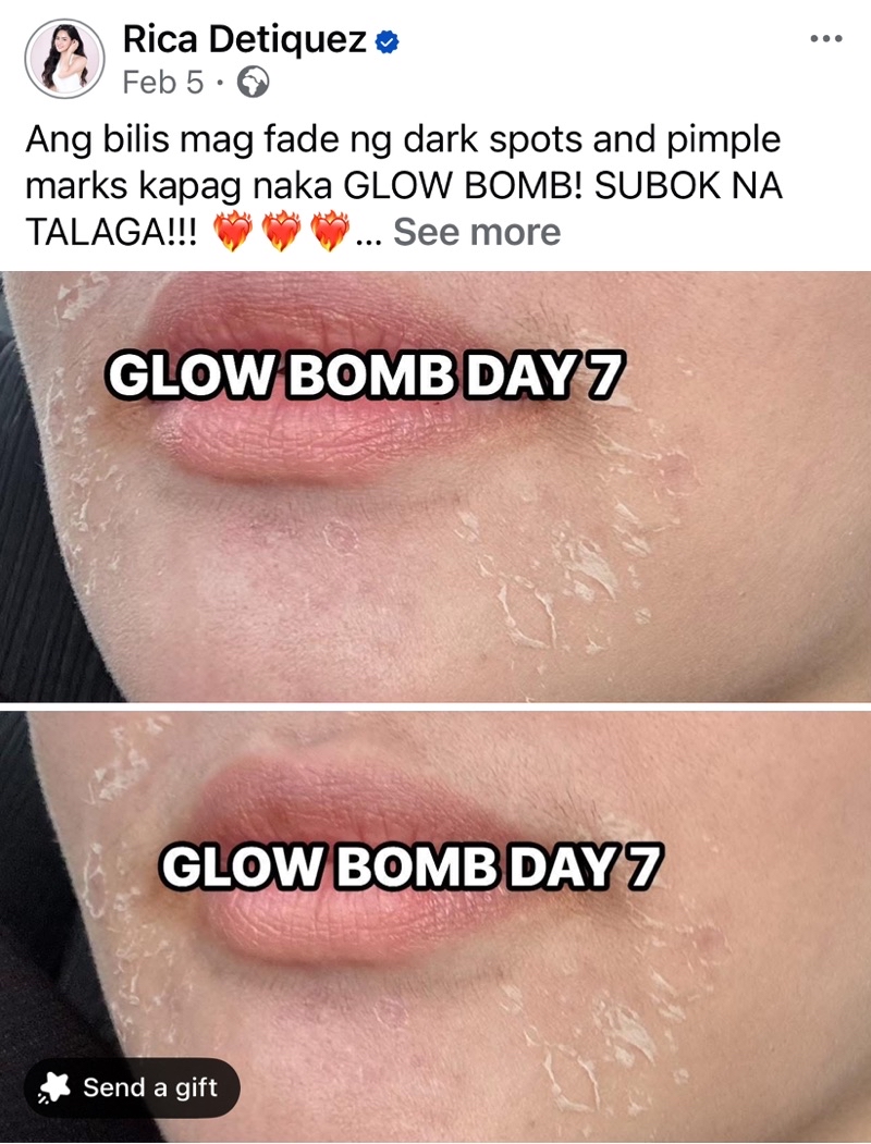 Ryx GLOW BOMB: Advanced Exfoliating & Rejuvenating Skincare Set (OG ...