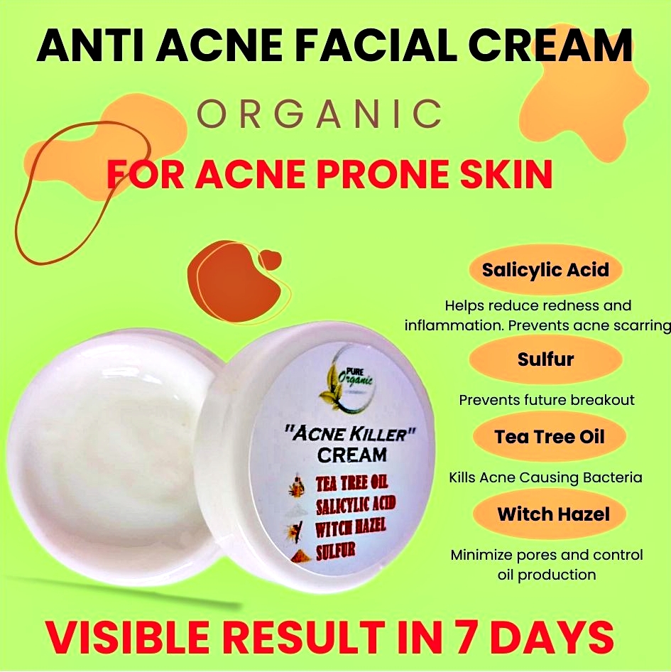 Pure Organic Anti Acne Cream With Salicylic Acid Sulfur Tea Tree Oil and Witch Hazel Extract ...