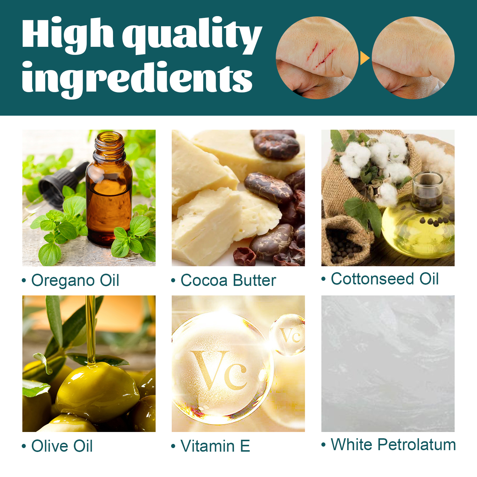 Ximonth Triple Antibiotic Ointment 28g Wound Care Ointment Scar Fading Wound Repair Treatment ...