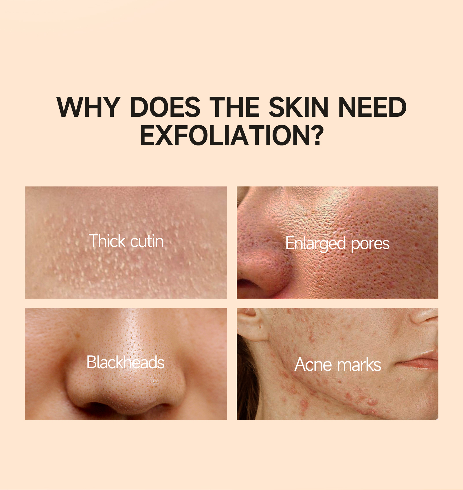 GMEELAN Orange Exfoliating Whitening Gel Facial body Scrub Peeling ...