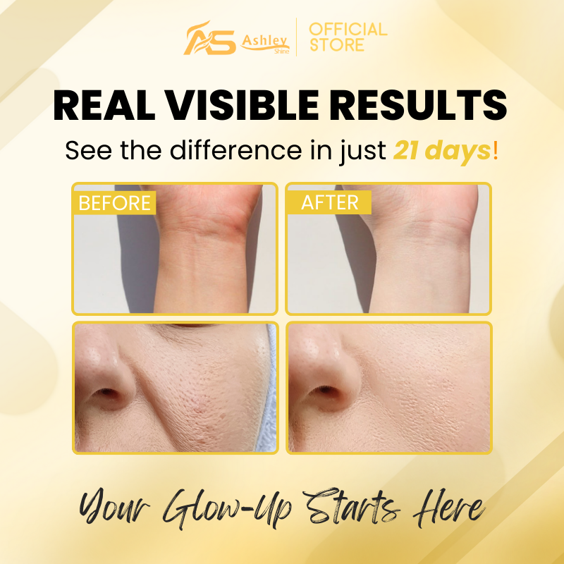 Ashley Shine Niacinamide Pure Serum Moisturizes Whitening Soothes Skin ...