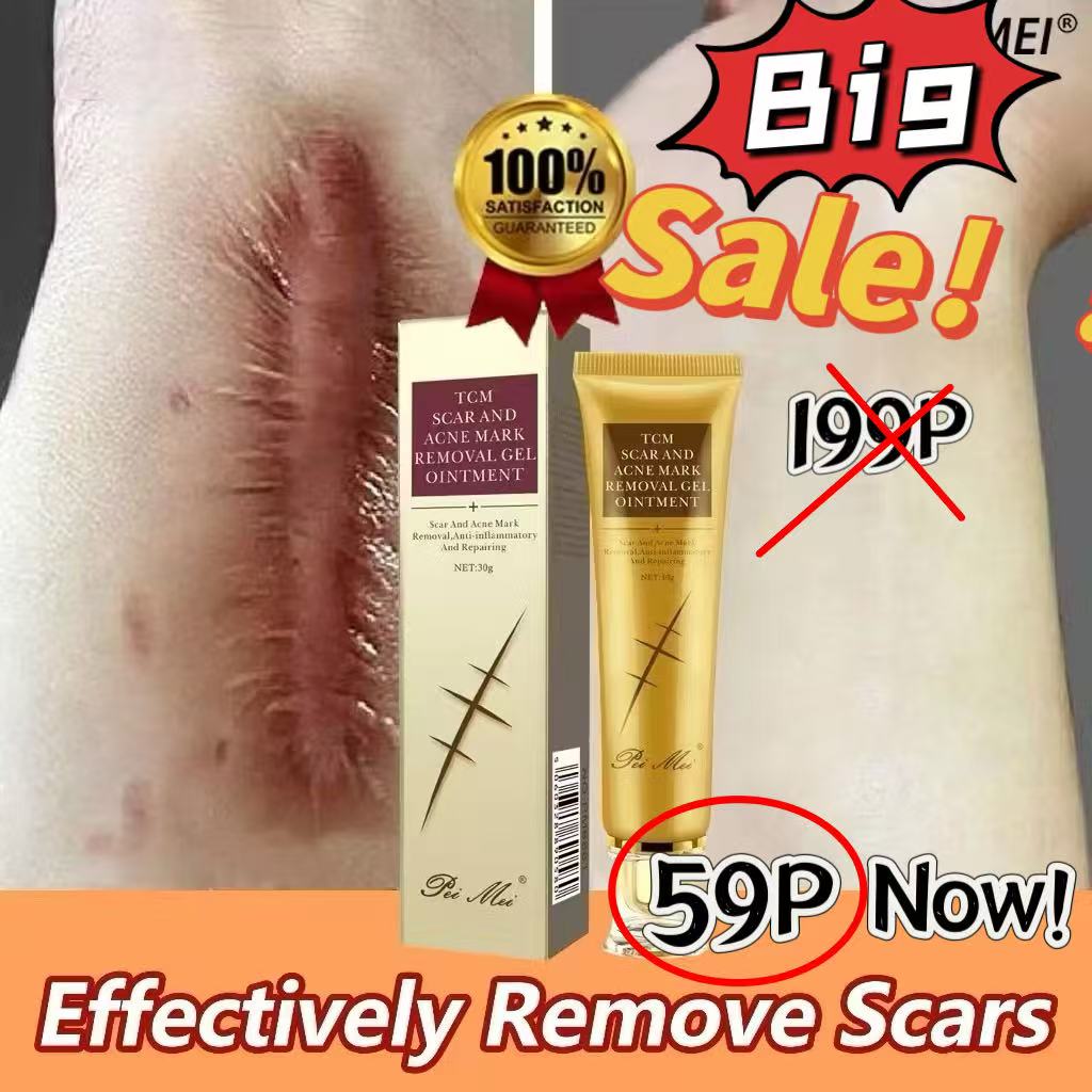 BIGSALE!! Original Labena TCM Scar And Acne Mark Removal Gel Ointment ...