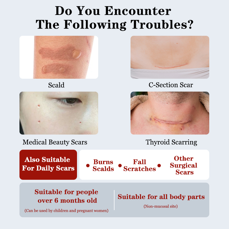 Sol lora Deep repair damaged skin scar removal cream accelerates scar ...