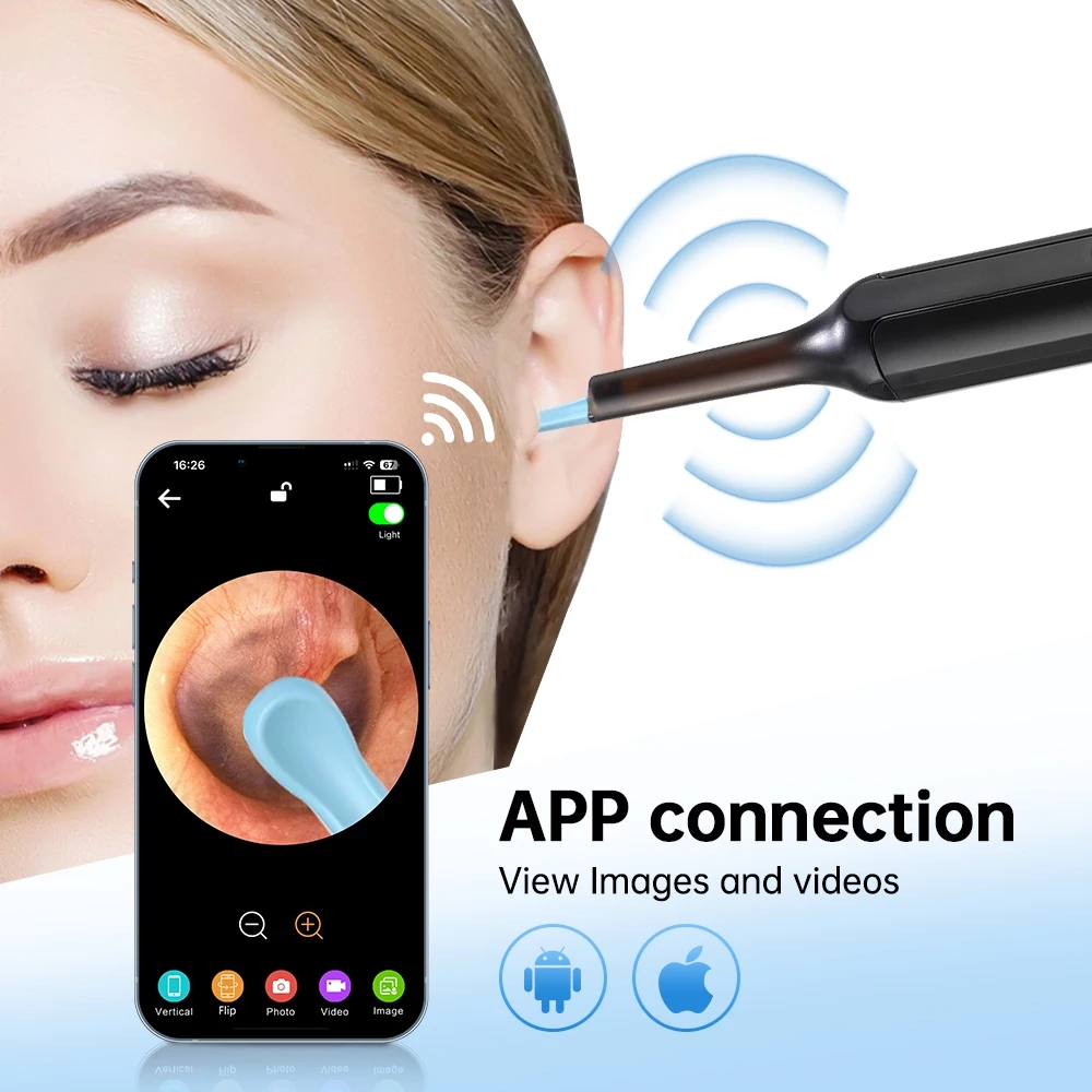 Wireless WiFi Ear Cleaner Intelligent Ear Pick with Camera Visual Ear ...