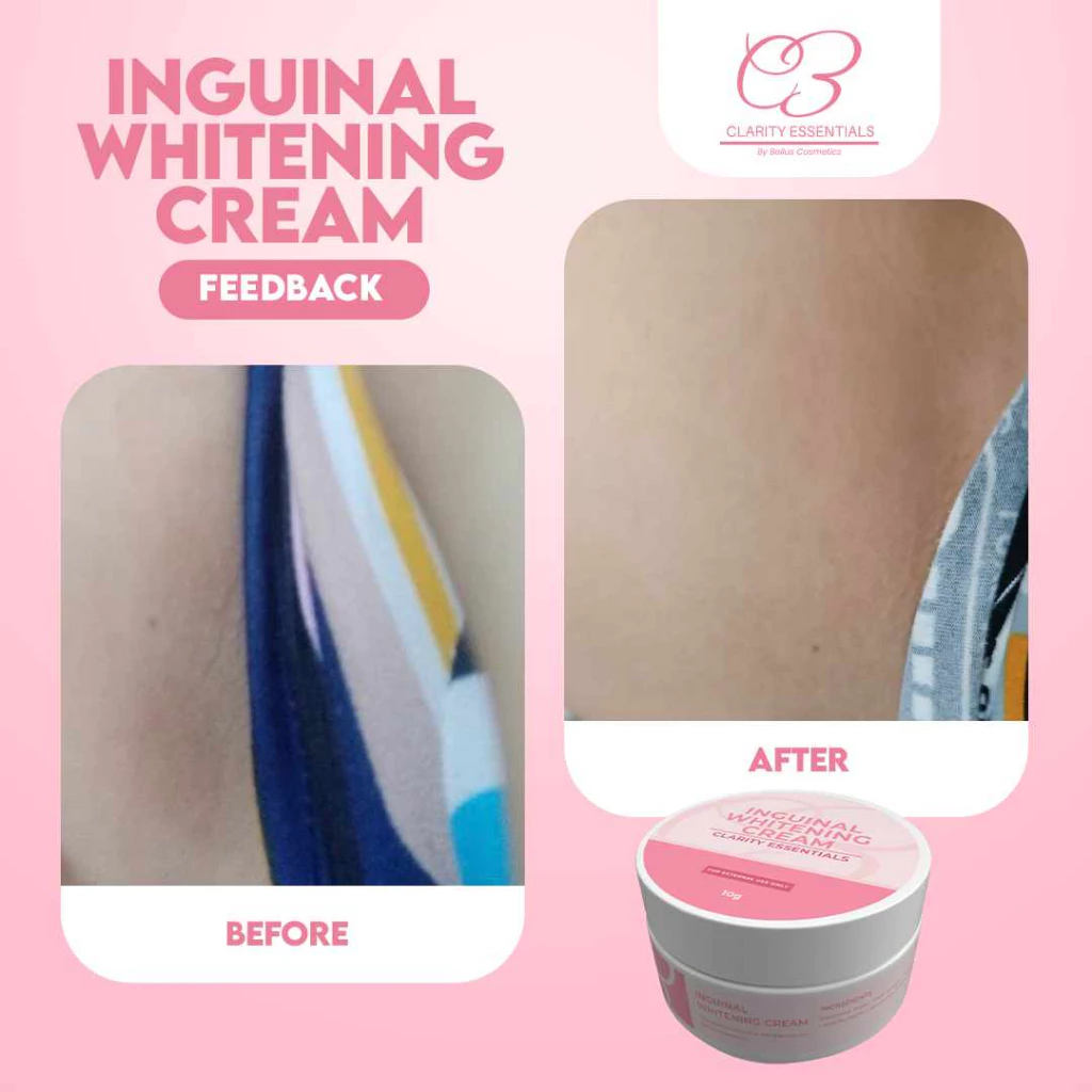 Inguinal (Singit) Whitening Cream by Clarity Essentials 25ml | Shopee ...