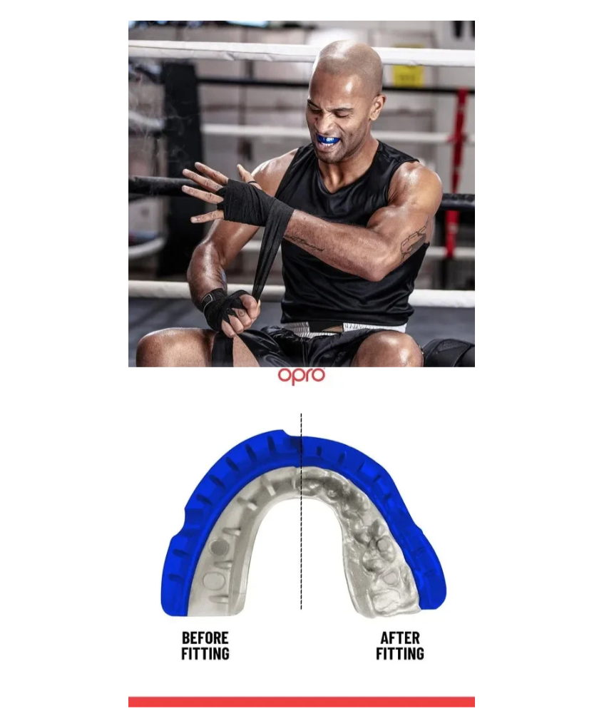 Opro Mouthguard Self-fit Gen5 Gold Braces | Shopee Philippines