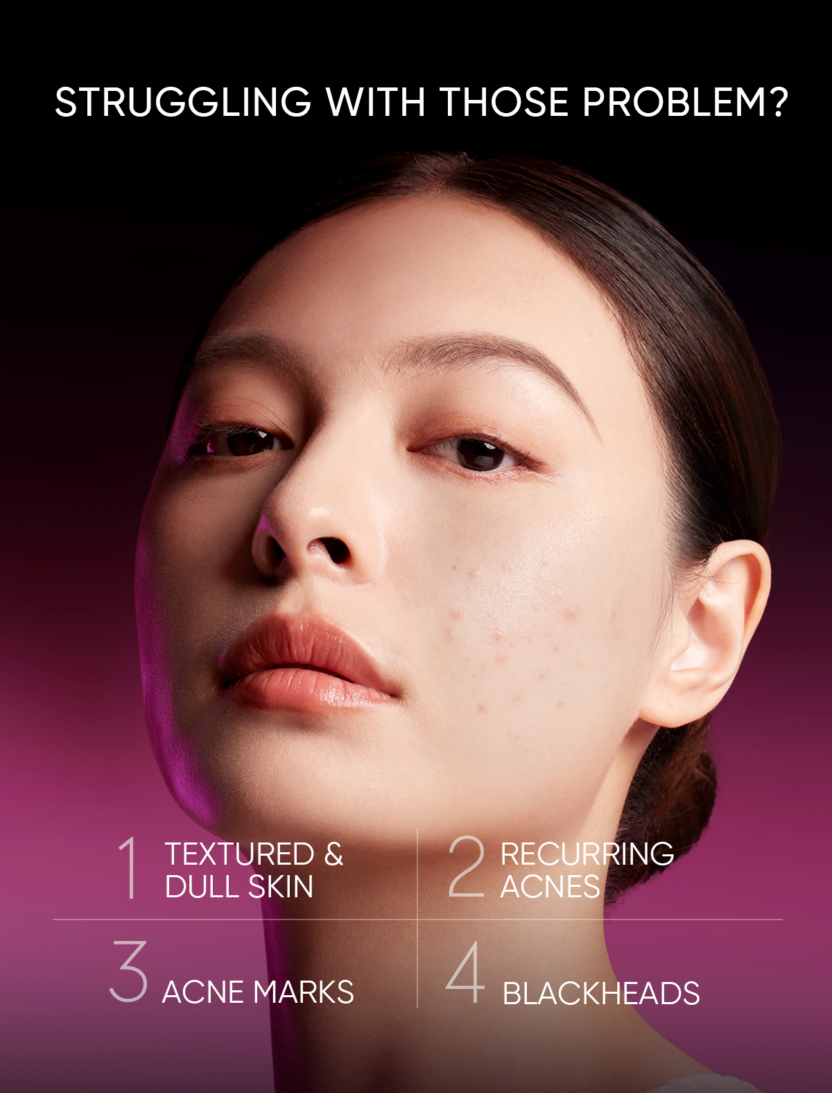 [Smooth Skin] SKINTIFIC 12% AHA BHA PHA LHA Peeling Solution Serum 30ml ...