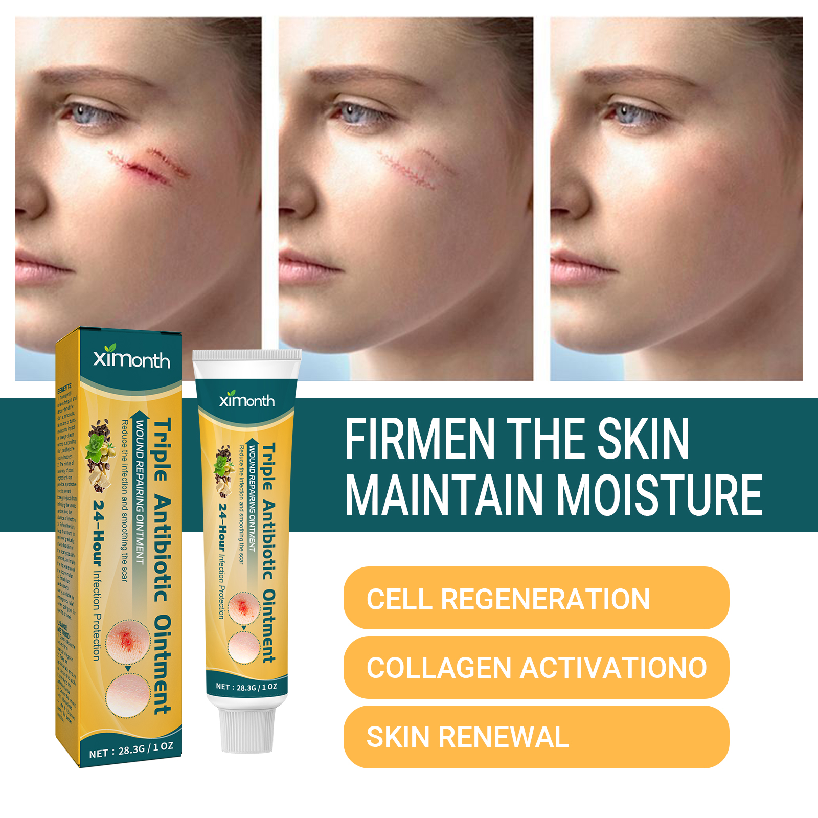 XIMONTH Antibiotic Ointment for Wound Healing and Infection Prevention ...