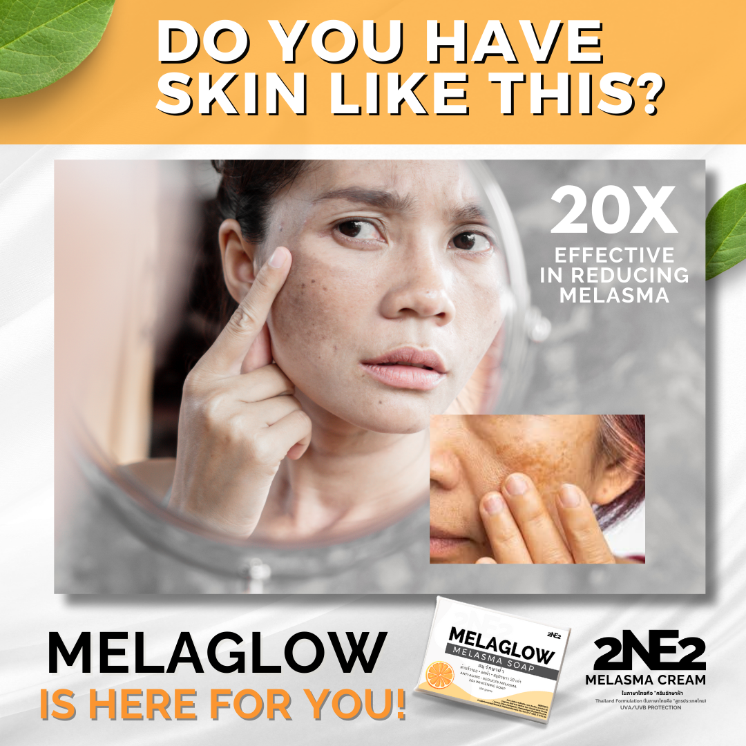 MELAGLOW Melasma Soap-Melasma,Pekas,Hyperpigmentation,Dark Spot ...