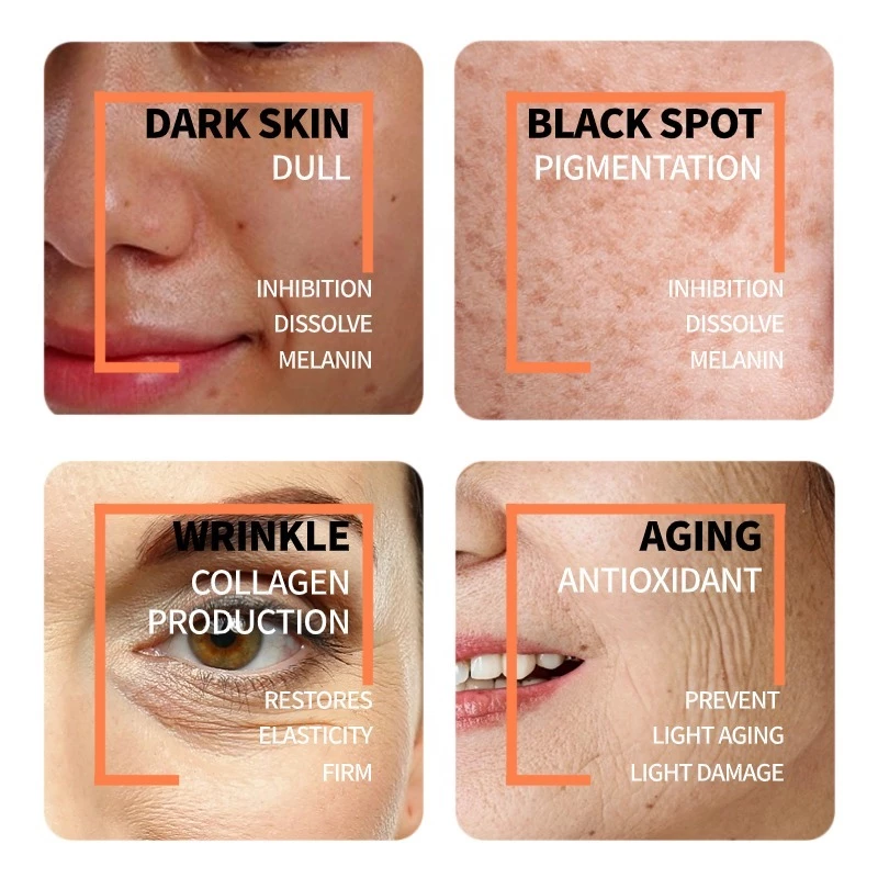 The Ordinary Retinol1% Serum Brightest Skin Melasma Remover Anti-Aging ...