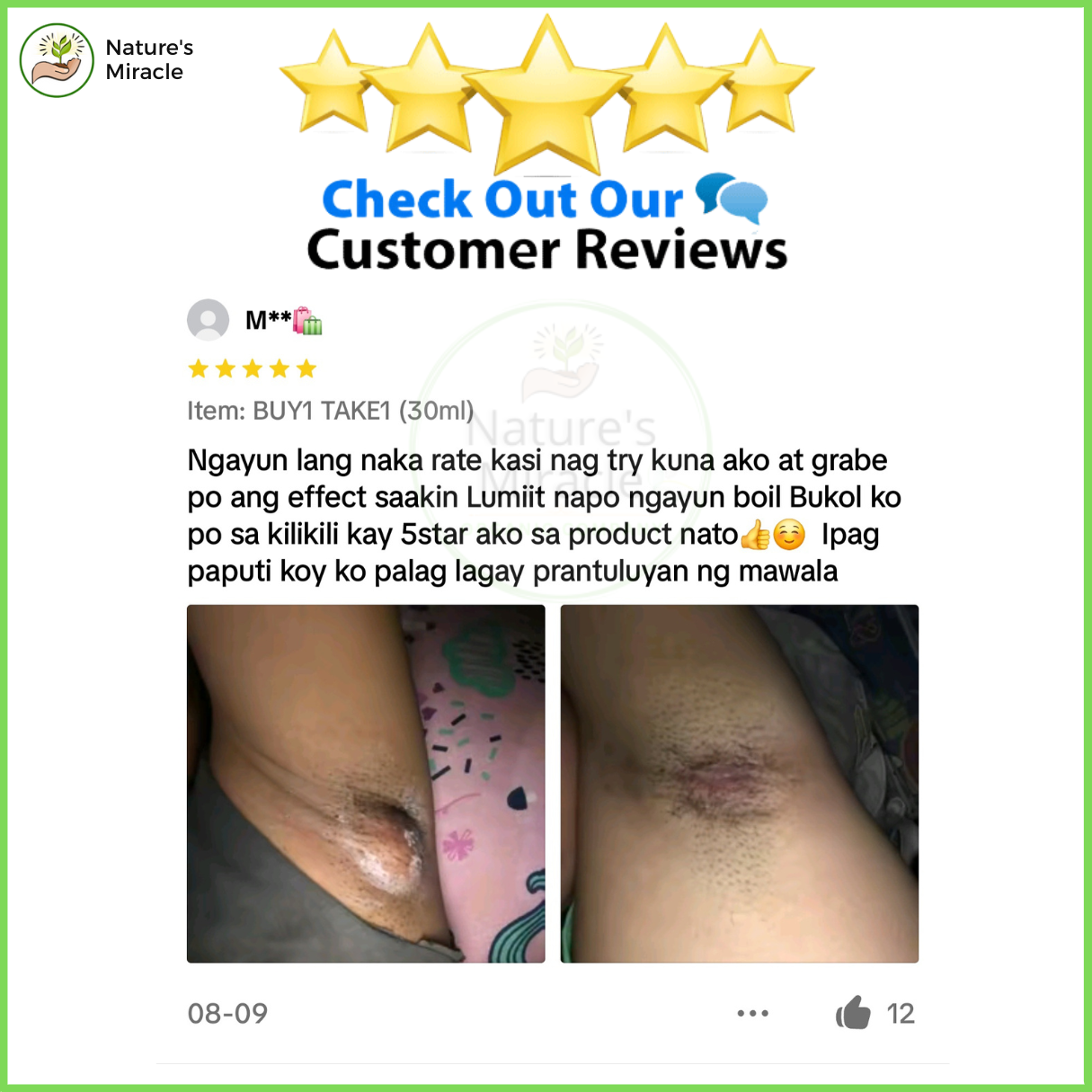 bitoon herbal for bukol original bitoon herbal oil original bitoon ...