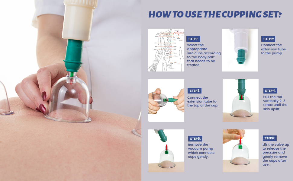 KIKOT 12pcs Ventosa Set Traditional Ventosa Cupping Set Massage Ventosa ...