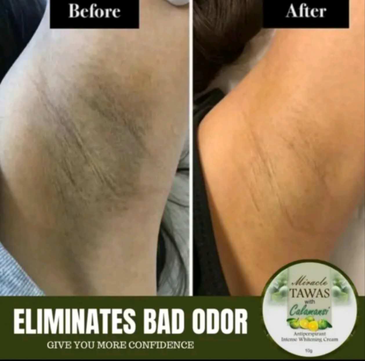 【BUY 3 Take 3】Miracle Tawas with Calamansi Underarm Whitening Deodorant ...