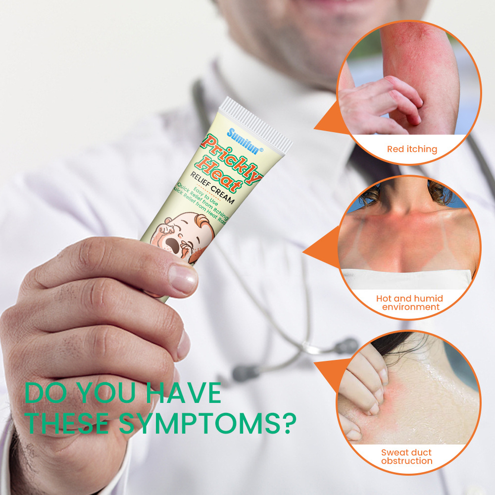 Anti-itch Cream Prickly Heat Ointment Gentle On Skin Herbal Cream For ...