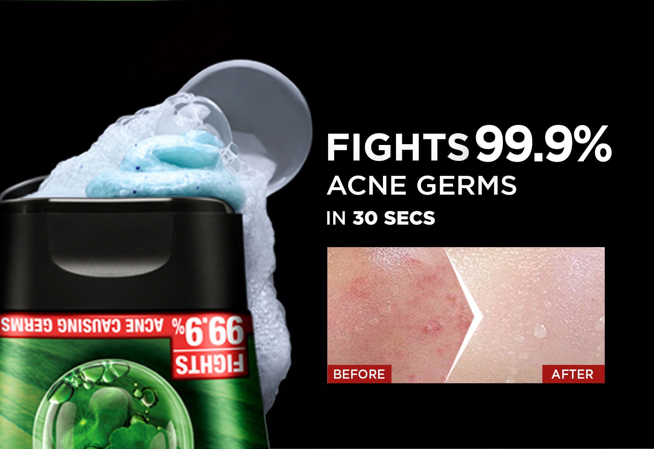 NEW Garnier Men Acno Fight Anti-Acne Scrub in Foam Cleanser (50ml/100ml) - for pimples, acne ...