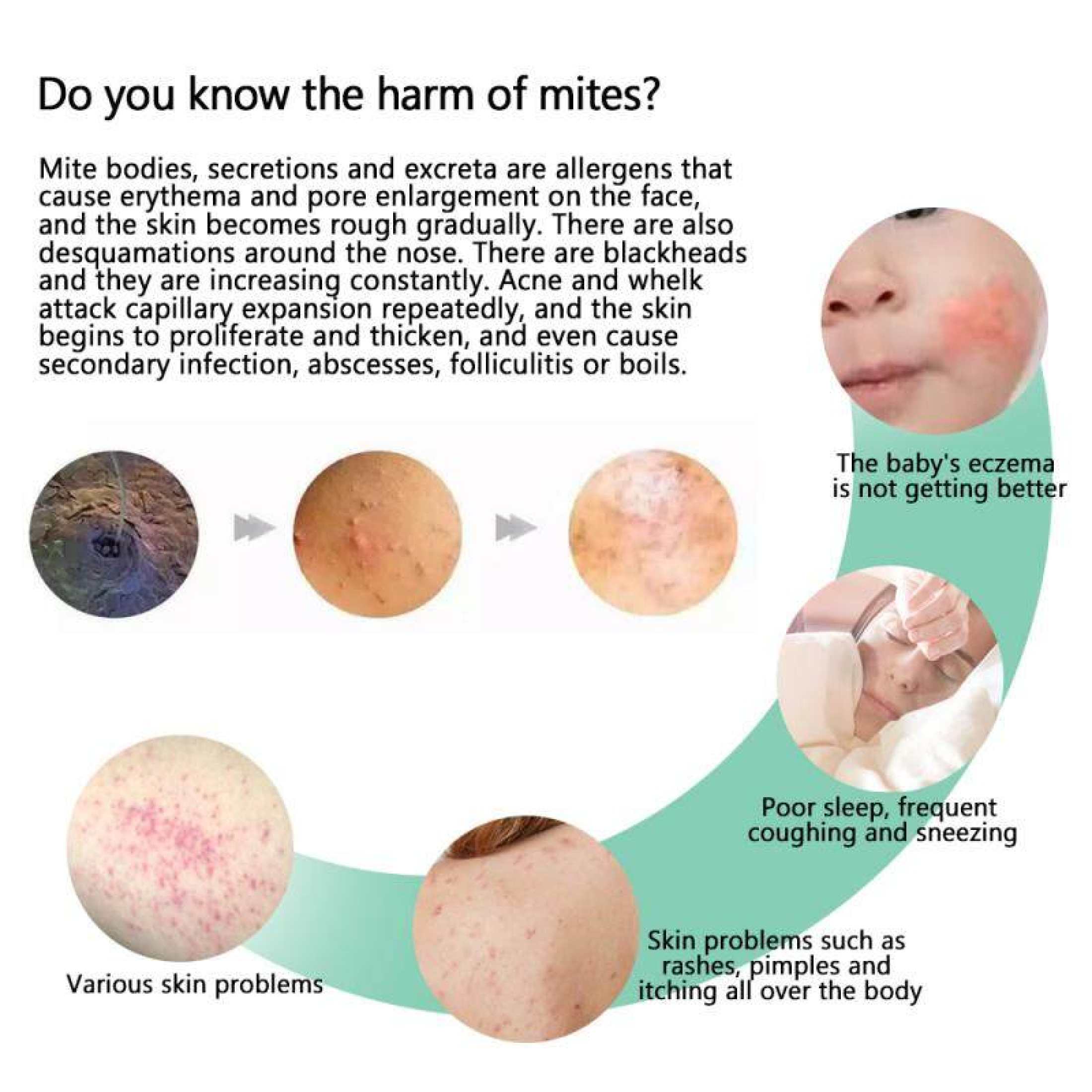 Mite removal spray, dust mite removal agent, anti-mite spray, bedding ...