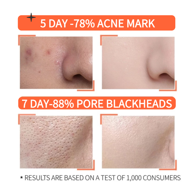 The Ordinary Skin Smoothing Set Glycolic Acid 7% Toning Solution ...