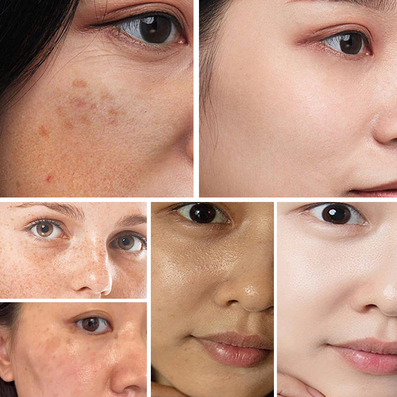 AXIS-Y Dark Spot Correcting Glow Serum Dark Spots Whitening Serum ...