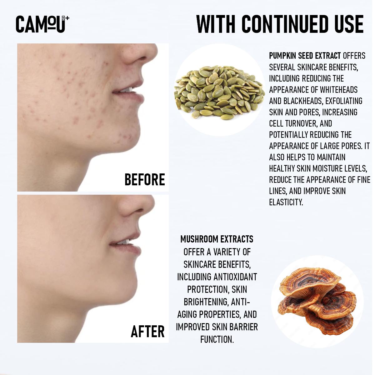 Camou Anti Acne Spot Correction Cream Colloidal Sulfur Niacinamide ...