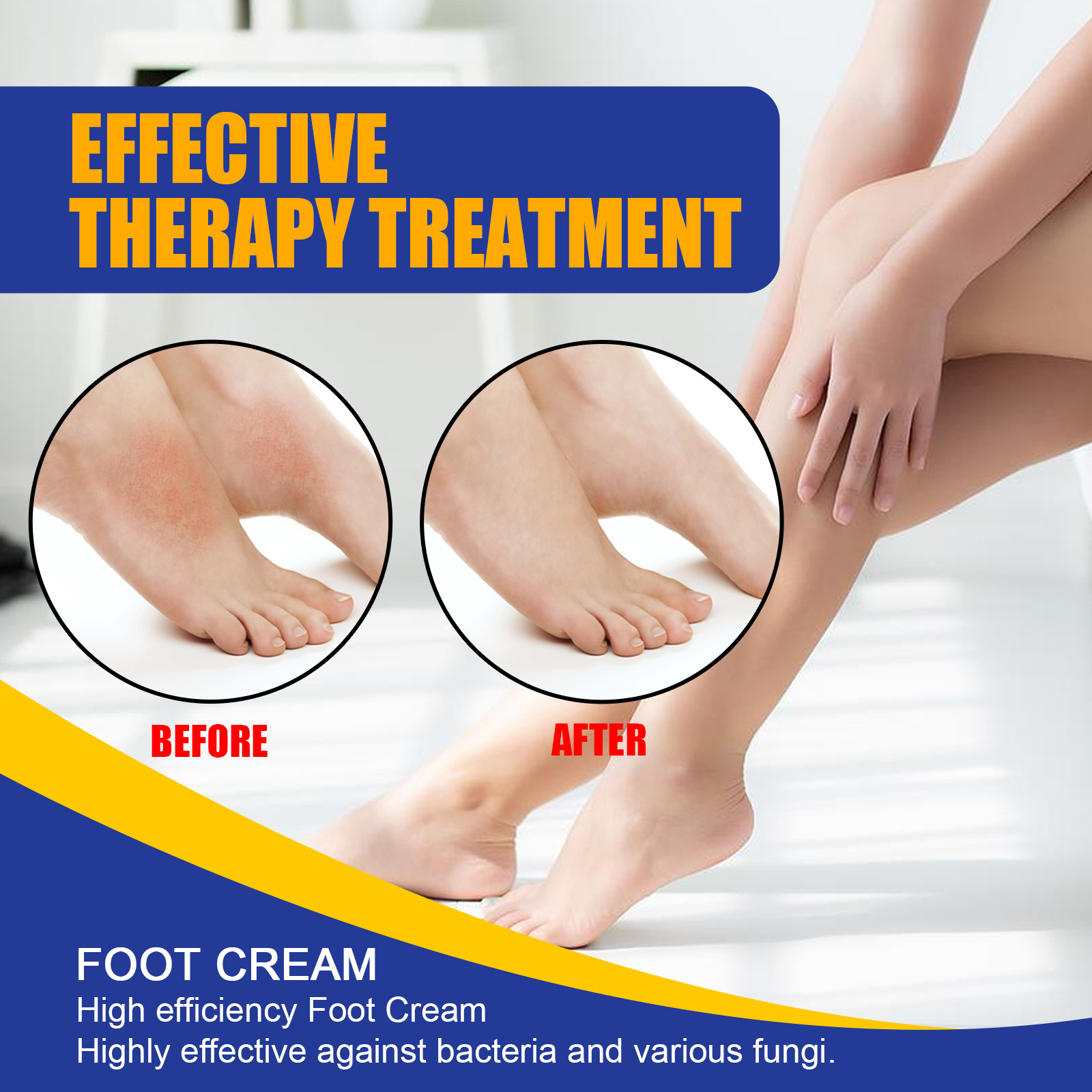 Foot Anti Fungal Cream Athlete's Foot Treatment Cream Antibacterial ...