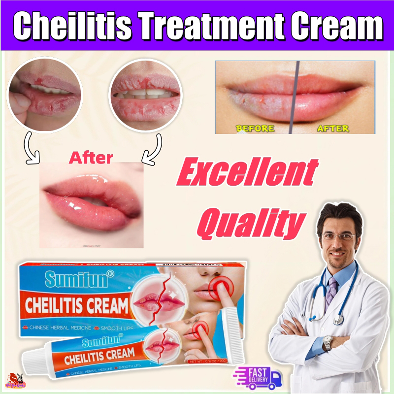 Cheilitis Cream Inflammation Labial Herpes Antibacterials Chapped Lips Wrinkles Rehydration ...