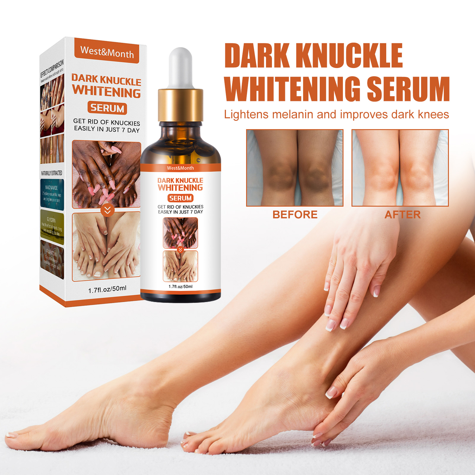 West&Month Dark Knuckle Whitening Serum 50ml Knee Whitening Liquid ...