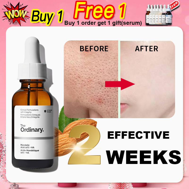 The Ordinary facial serum Retinol/Niacinamide/salicylic/Hyaluronic ...