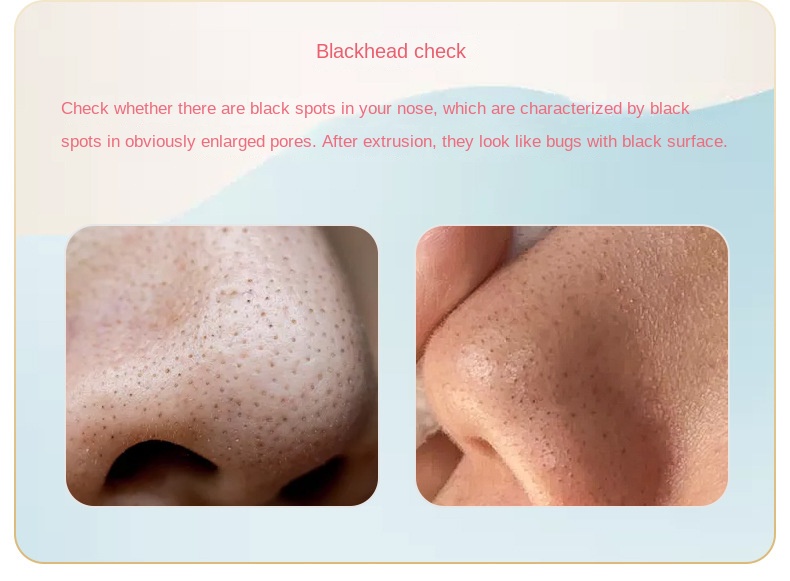 10pcs Deep Cleansing Nose Strip Blackhead Remover Clean Nose Pore ...