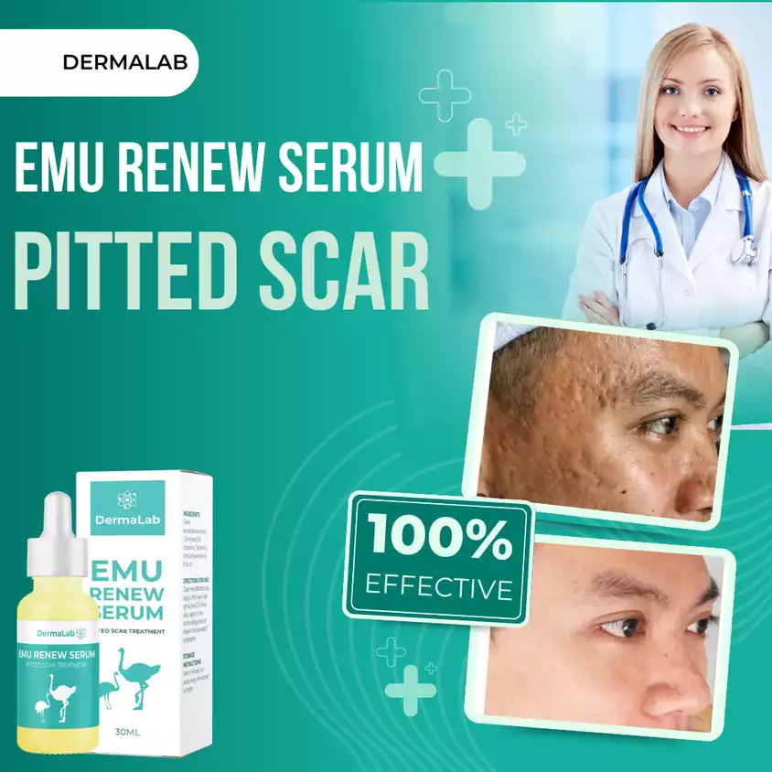 Dermalab Emu Renew Serum, Pitted Scar Treatment Serum, Safe for Skin | Shopee Philippines